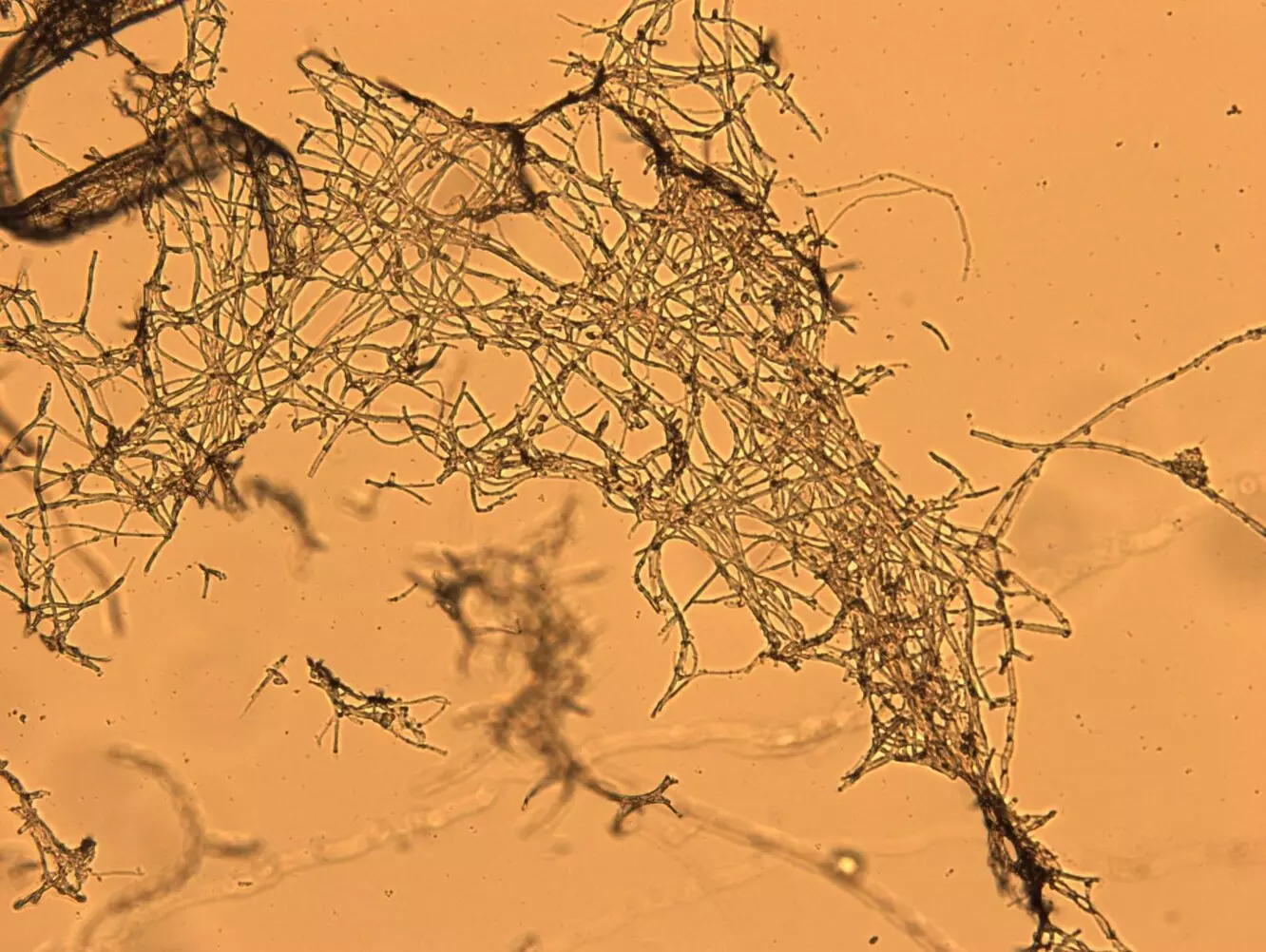 Microorganisms - manimba ny oxalic cystol