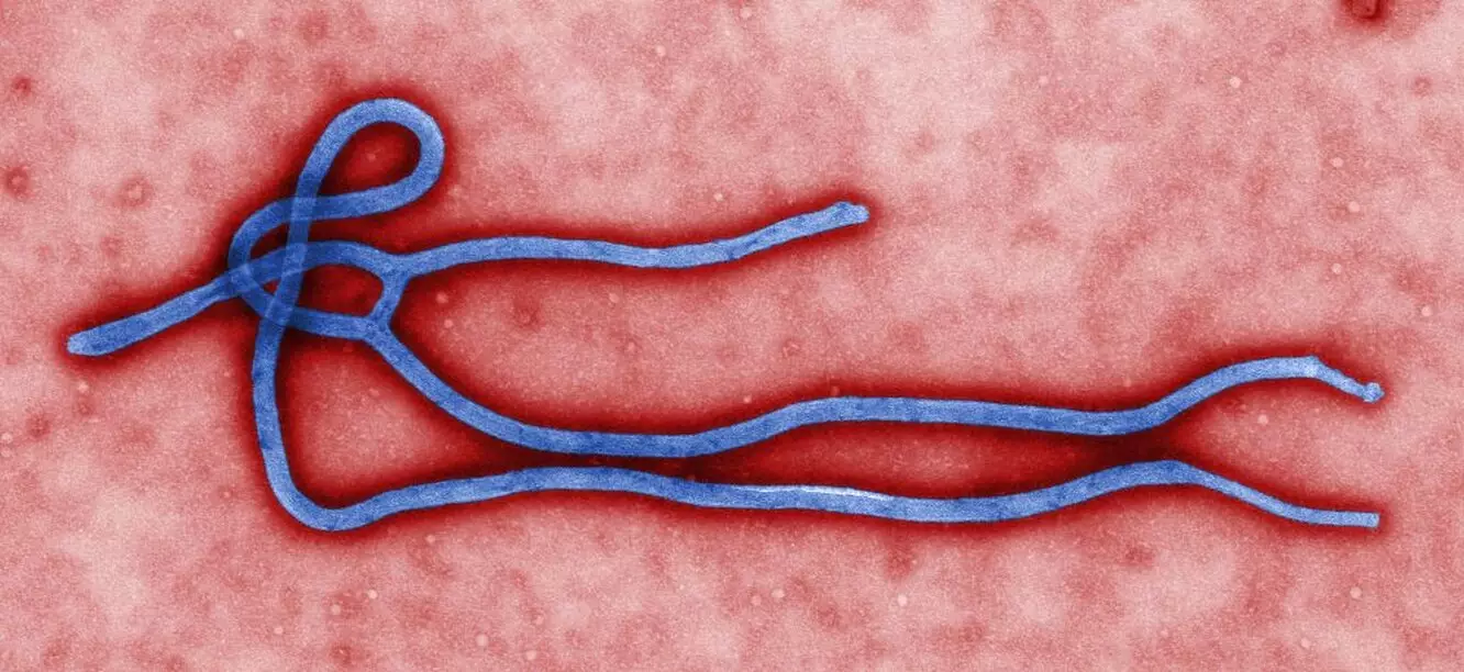 Virus ebole.
