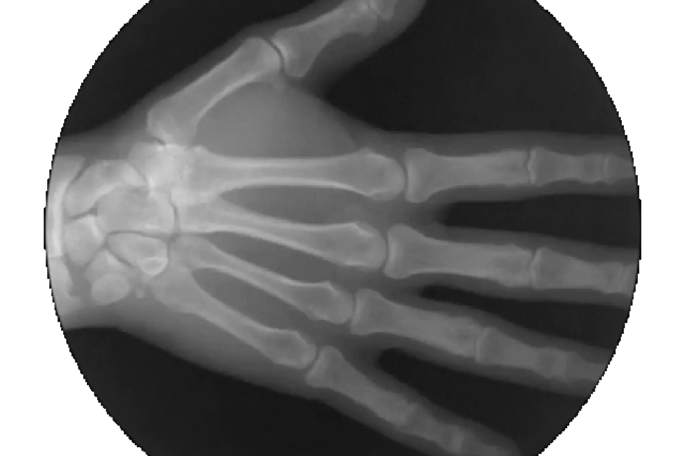 Видеата со рендген прикажуваат зглобови во движење