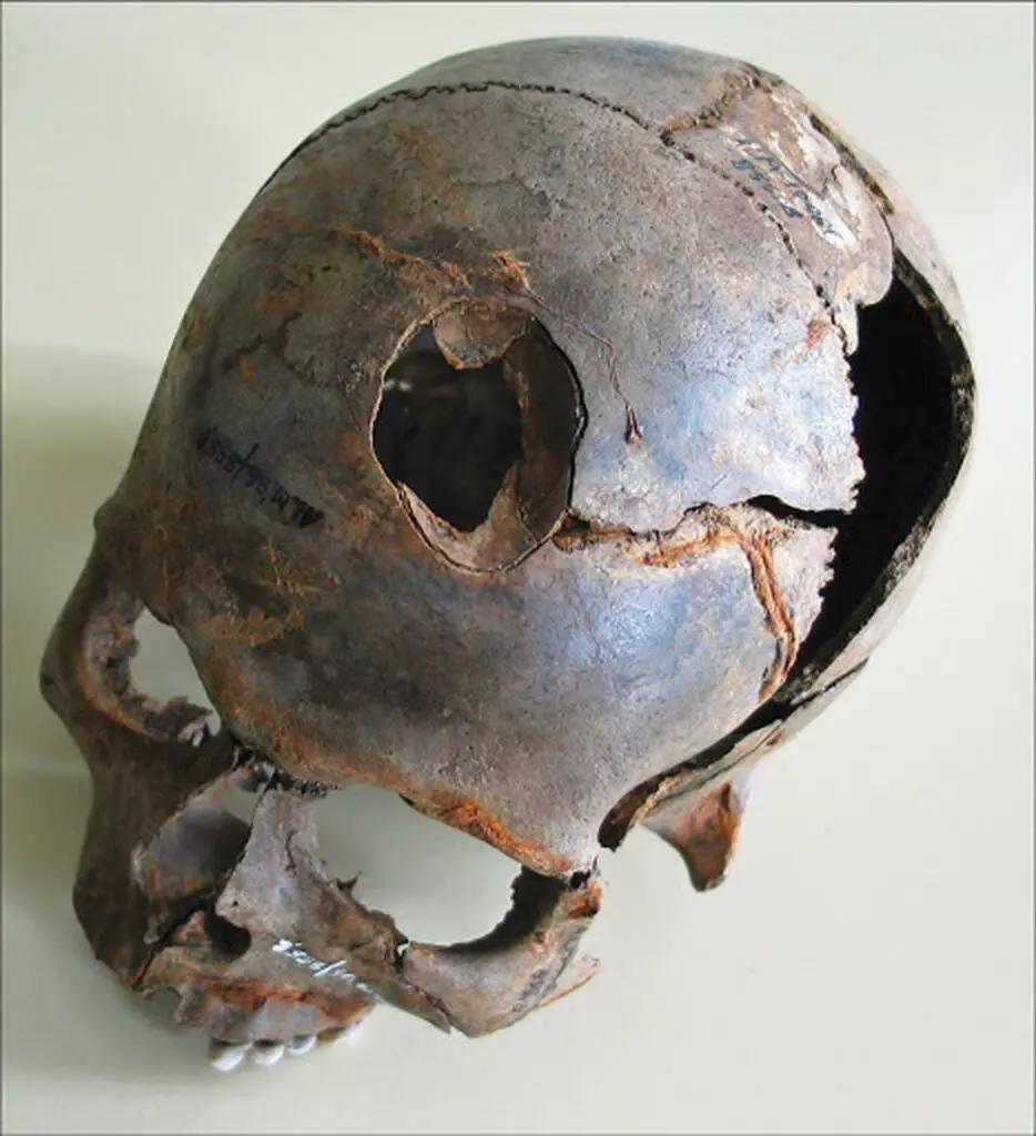 skull