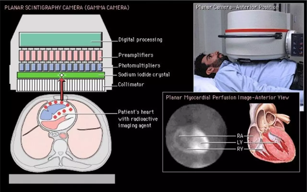 How to examine in detail the internal organs of a person with minimal intervention? By using a radioactive isotope with a very short half-life that does not harm the body. The patient is injected with a drug with a radioactive marker, thanks to which the doctor can obtain an image of the organ and assess its condition. Often this method is used to diagnose heart disease.