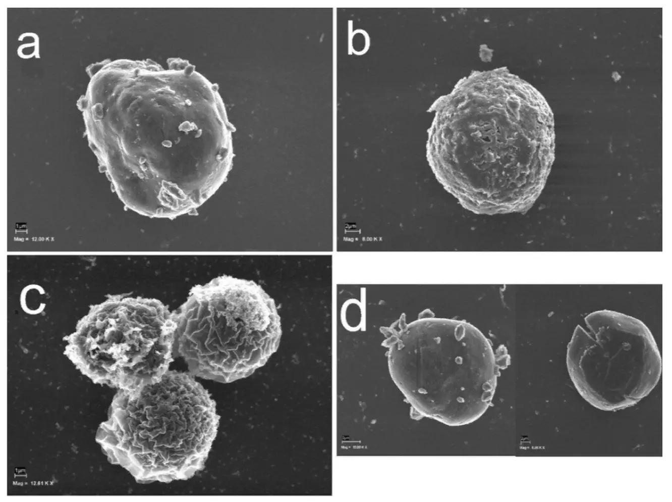 cysts ປັບຕົວກັບຄວາມເຢັນຂ້ອນຂ້າງທົນທານ. ພວກມັນທົນທານຕໍ່ອຸນຫະພູມລົງເຖິງ -21 ອົງສາເປັນເວລາ 100 ມື້, ແລະໃນນ້ໍາແລະດິນພວກເຂົາຮັກສາອາການຂອງຊີວິດເປັນເວລາ 2-3 ເດືອນ, ດັ່ງນັ້ນພວກມັນສາມາດປຸກໄດ້ຖ້າໂອກາດເກີດຂື້ນ.