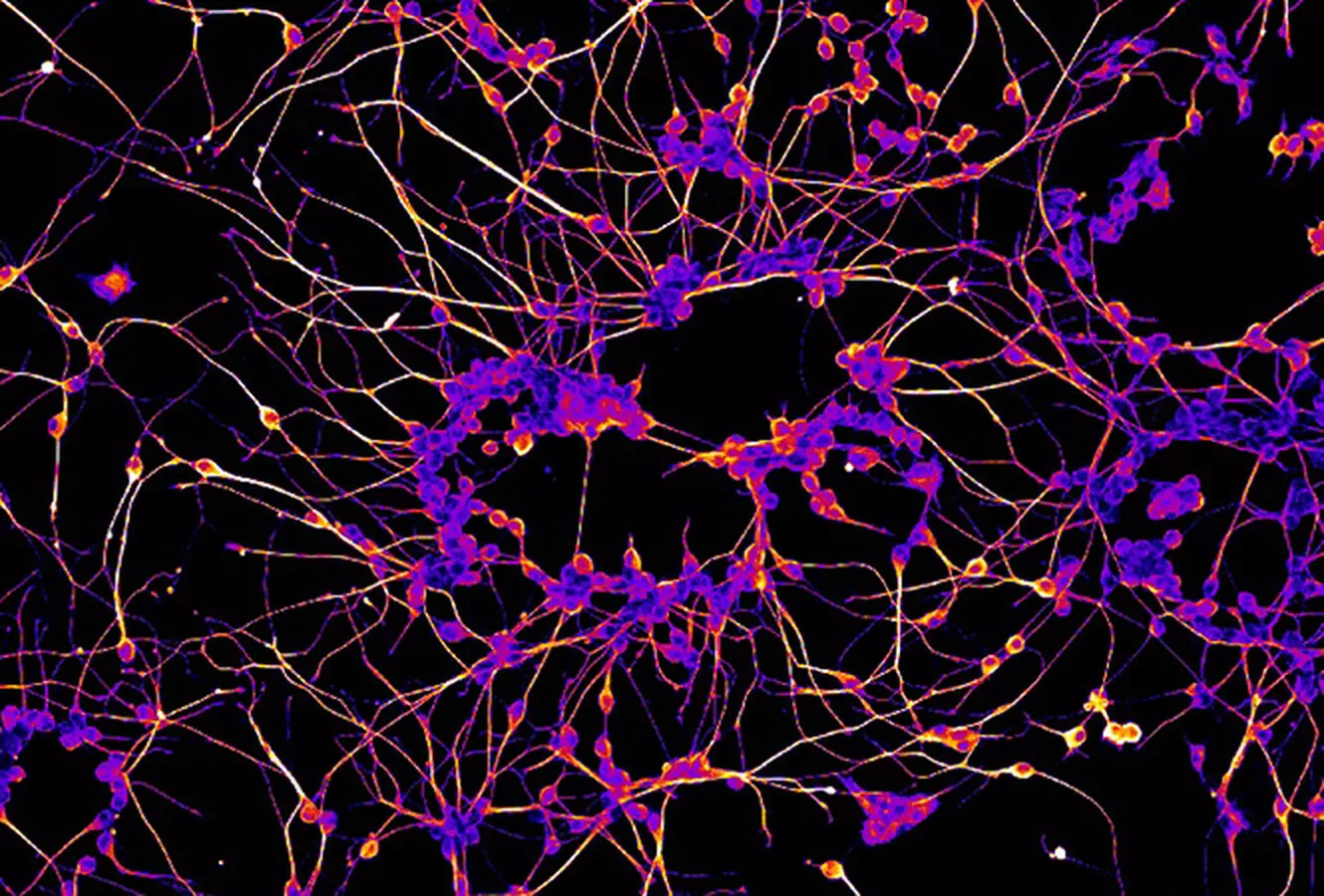 Axons اعصاب خاني جا ڊگھا خيما آهن.