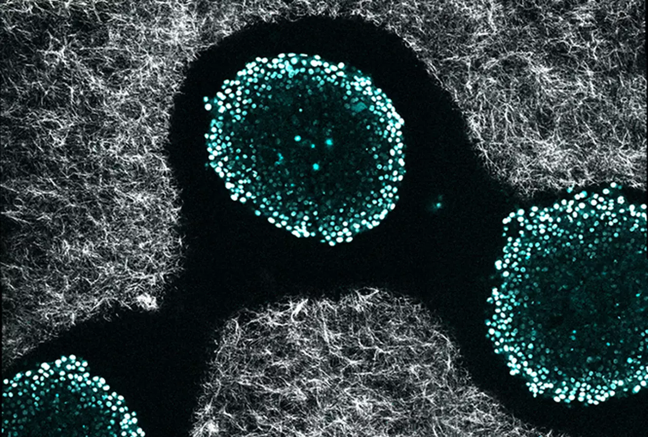 Tre klynger af kræftceller (hvide-blå prikker) indlejret i en tredimensionel matrix af proteinfilamenter (hvide striber). På sådanne små tumorer studeres kræftcellers og metastasers adfærd.