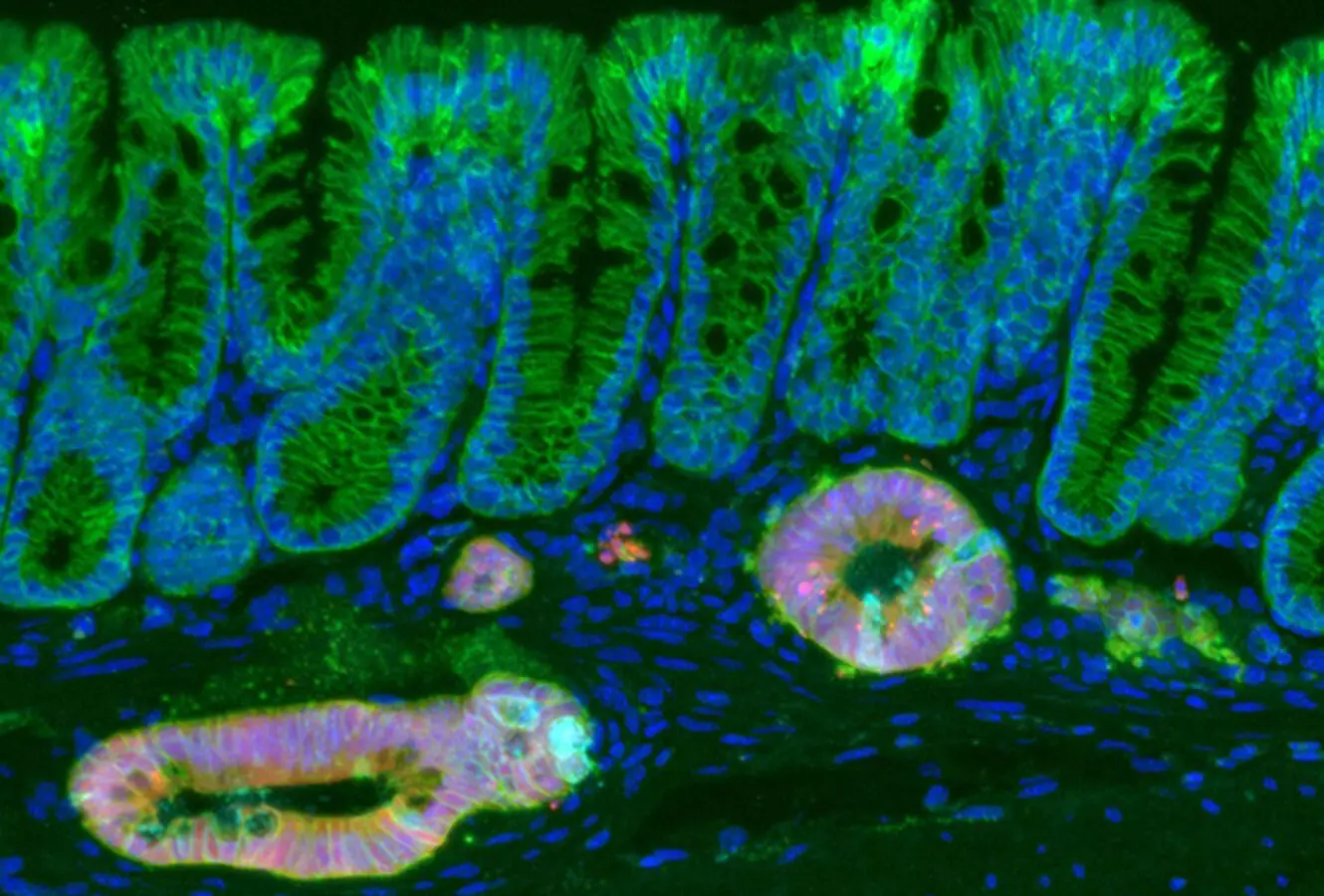 Organelles ni viungo vilivyokuzwa kwa bandia vilivyopandikizwa kwenye ukuta wa matumbo.