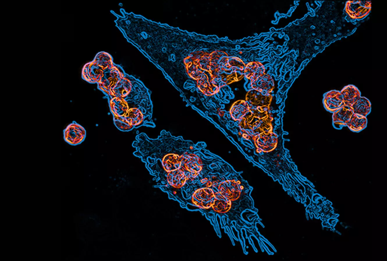 Mkpụrụ ndụ macrophage mmadụ (acha anụnụ anụnụ) ejidela mkpụrụ ndụ tumo (oroma) ndị e debere ọgwụ mgbochi na-achọpụta mkpụrụ ndụ na-alụso ọrịa ọgụ. Ndị ọkà mmụta sayensị na-arụ ọrụ iji dozie ọgwụ mgbochi na mkpụrụ ndụ kansa.