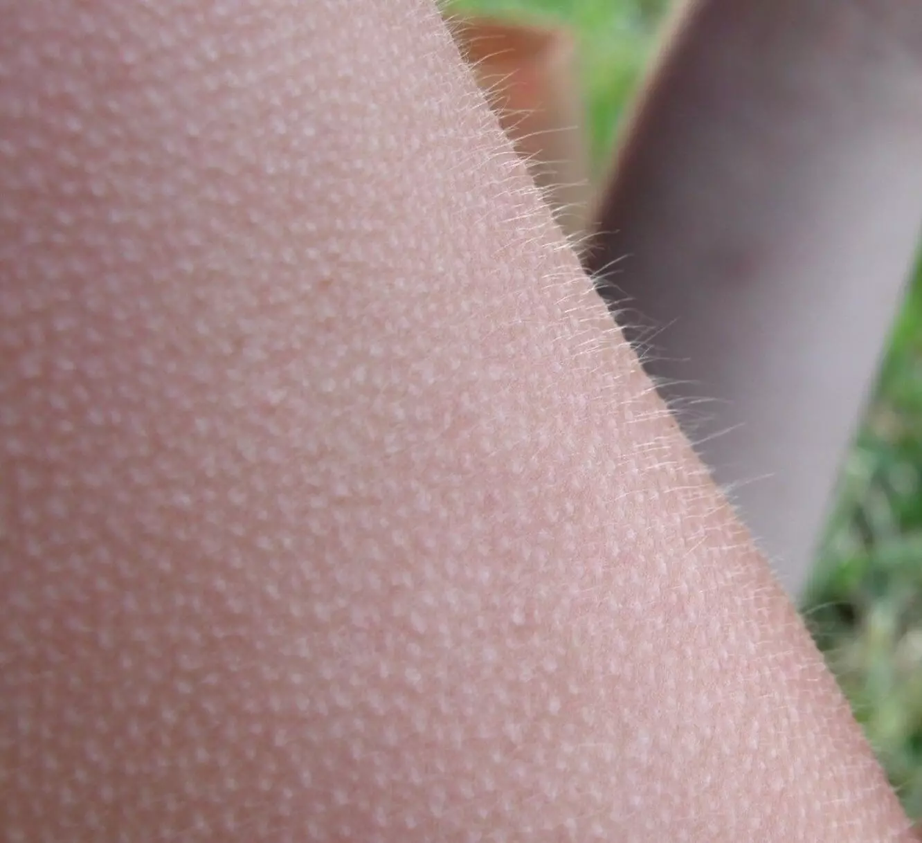 "Goosebumps" ama "goosebumps" waa naqaan dhammaanteen, iyo falcelintan sidoo kale waxay ku hartay dadka ka soo jeeda awoowayaashood aadka u fog. Meesha goosebumps, waa in ay jiraan timo taagan dhamaadka haddii ay dhacdo cabsi ama xanaaq. Xayawaanno badan ayaa leh falcelin la mid ah, laakiin kaliya bini'aadamka ayaa ka hela goosebumps dareenka wacan - farxad, raaxaysi, iwm.