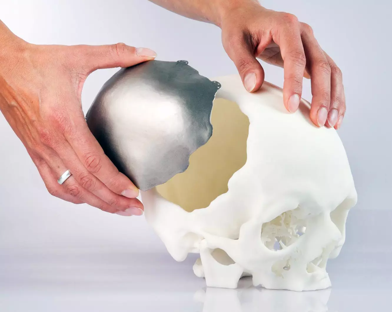 impianti medici. La notizia non è delle più recenti, ma comunque impressionante. La tecnologia consente di scansionare il corpo del paziente, quindi su una stampante 3D per creare un impianto che sia l'ideale per lui. Molto dipende dal materiale: a volte vengono utilizzate colture cellulari vive. Dai denti alle ossa - a seconda delle esigenze del paziente.