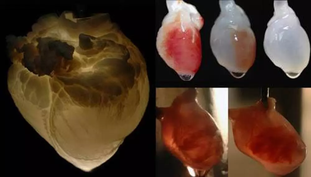 Sa wala mao ang matrix sa umaabot nga porcine heart, sa tuo mao ang anam-anam nga decellularization sa daan nga ilaga nga kasingkasing ug ang kolonisasyon niini sa buhi nga mga tisyu