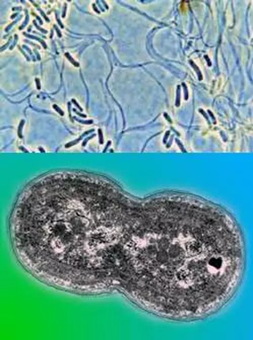 Cyanobacteria Synechococcus masero