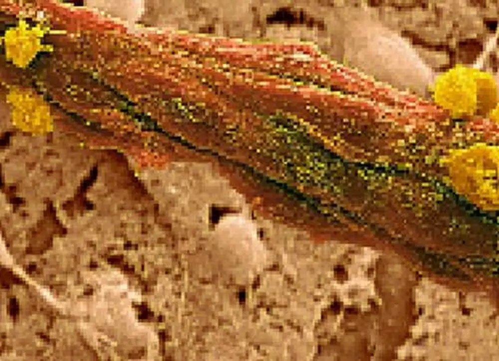 Stamceller Et farvet SEM-mikrografi, der viser klynger af differentierede humane stamceller (orange og mørkebrune) på et værtscellesubstrat (lysebrunt). Billedforstørrelse - 1300x