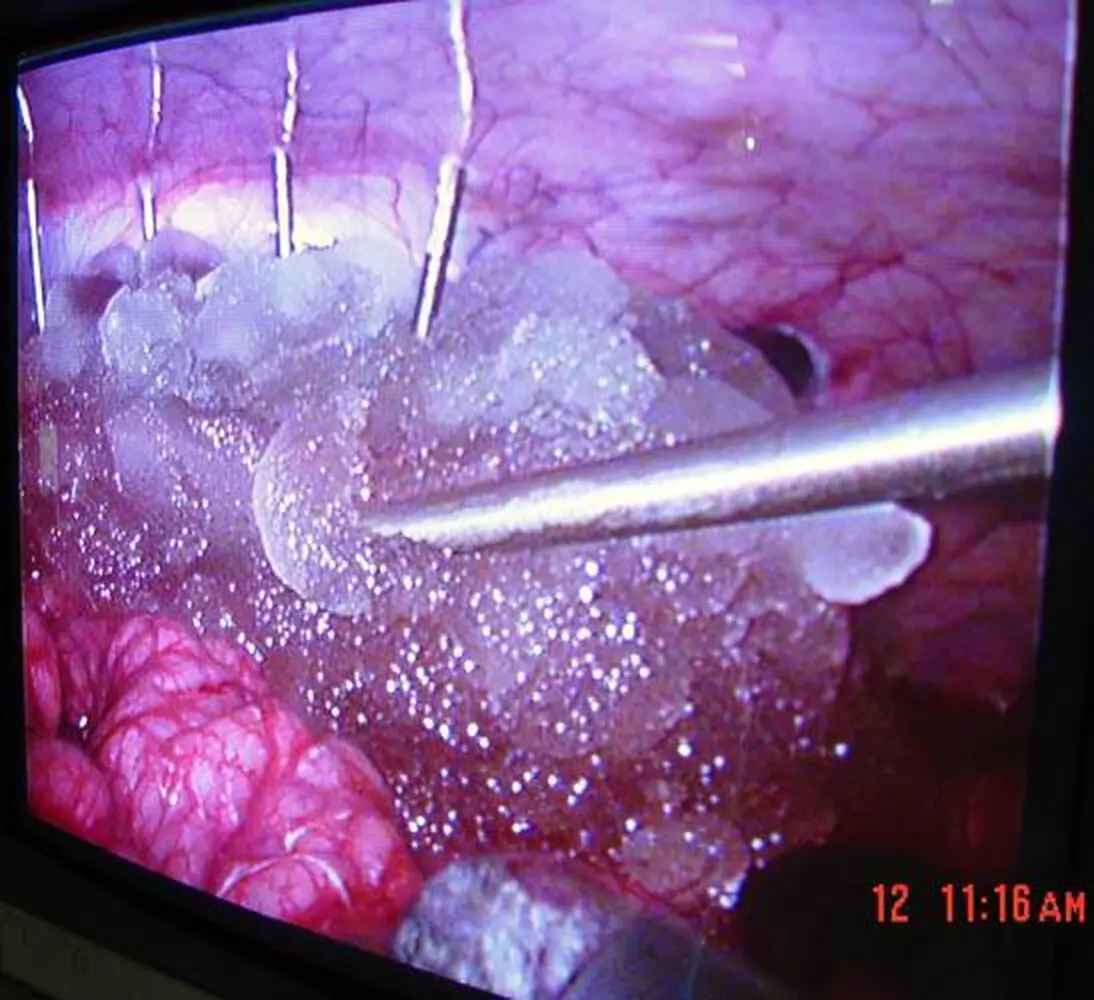 Test işlemi sırasında bir maddenin domuzun böbreği üzerindeki etkisinin endoskopik muayenesi