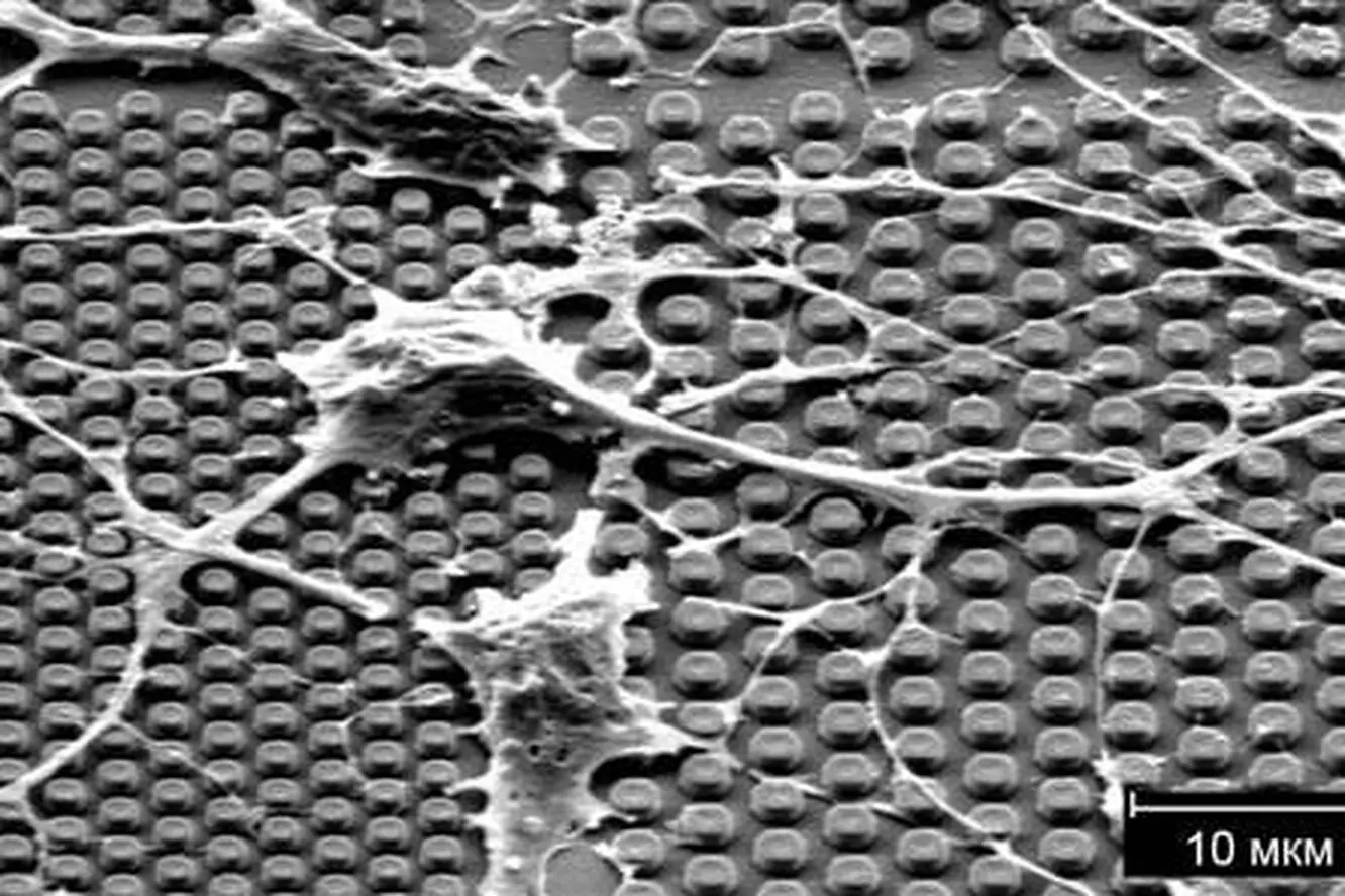 Microneedle: Neurometer