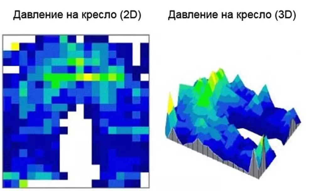 Разпознаване на меко петно: Любопитен стол 332327_2