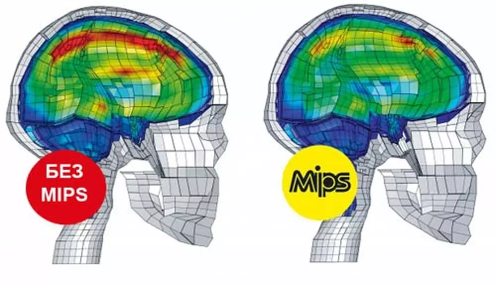 Die MIPS-helm is ontwerp om die impak op die brein van tangensiële impakte te verlig.