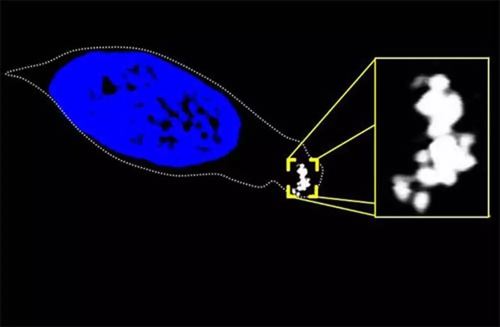 Magnetite deposits were found in the cells (highlighted in white), accumulating near the cell membranes, away from the cell nuclei (blue)