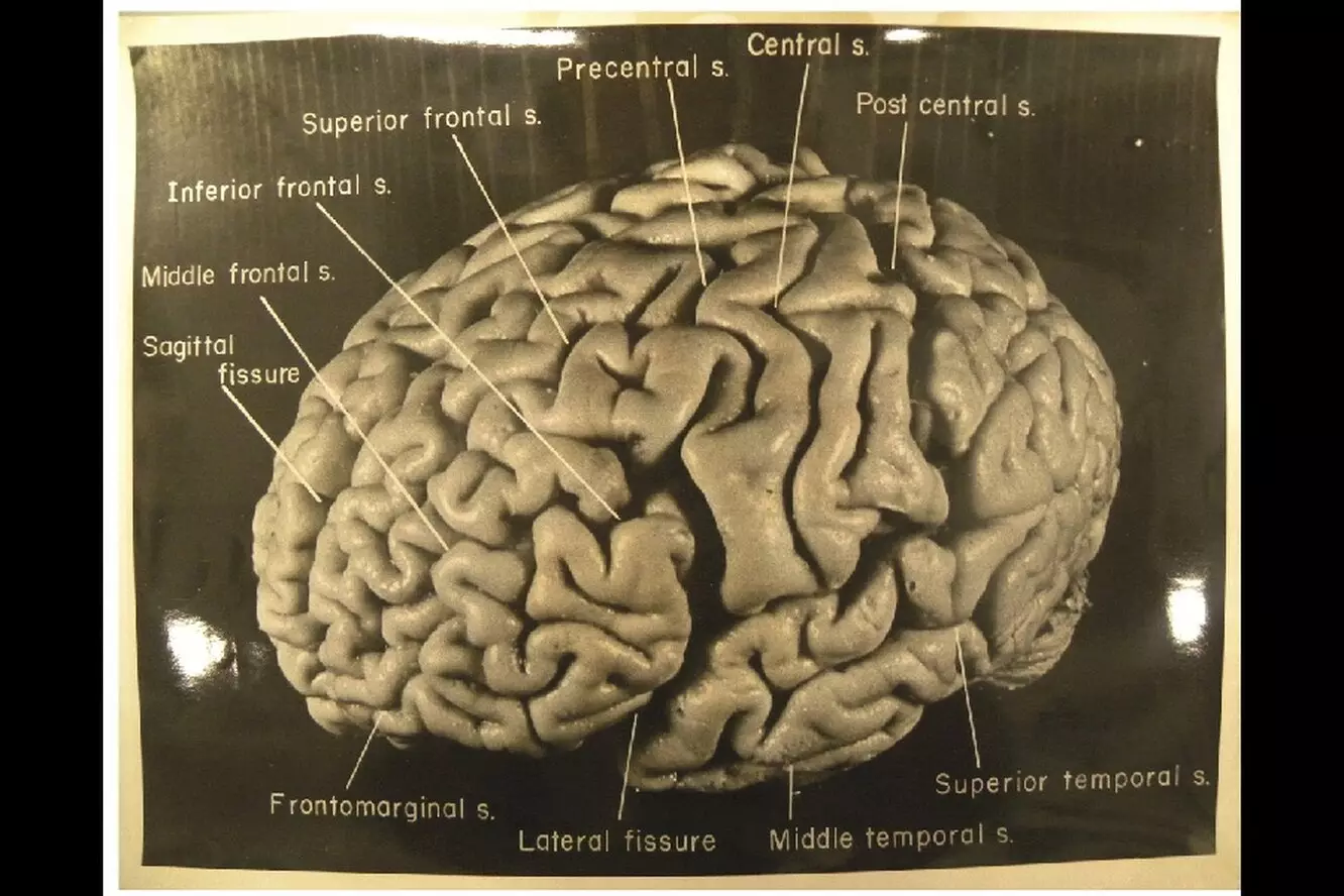 Cerebro de Einstein: circunvolucións 333229_1