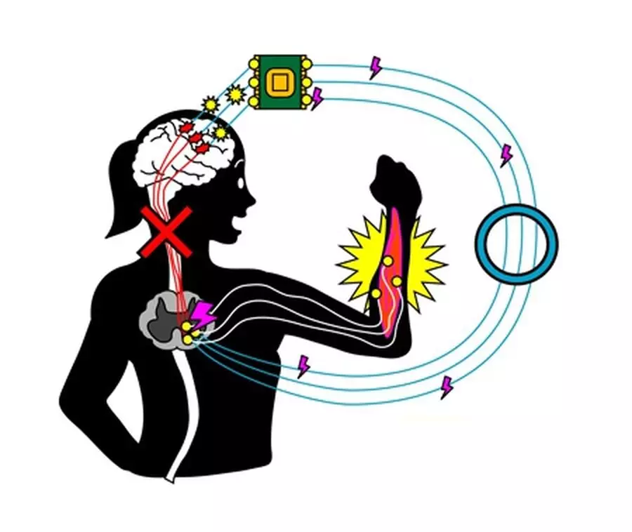 Pintasan: Sambungan Neural Buatan 334074_2