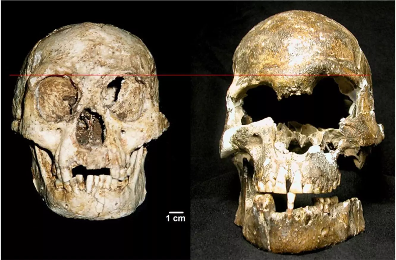 The same skull in comparison with another found on the island of Flores and dated 3-5 thousand years. It was assumed that the volume of the brain of a new species of man was less than 1/3 of the brain of Homo sapiens.