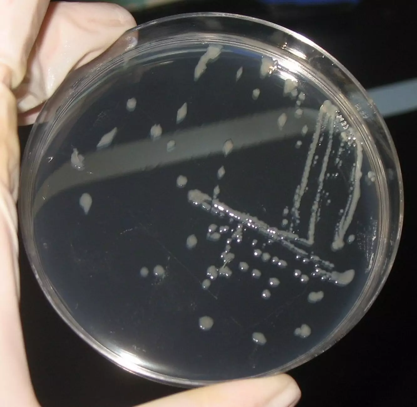 E. coli.