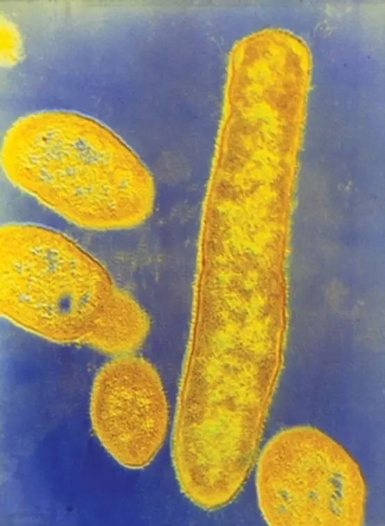 Escherichia coli.