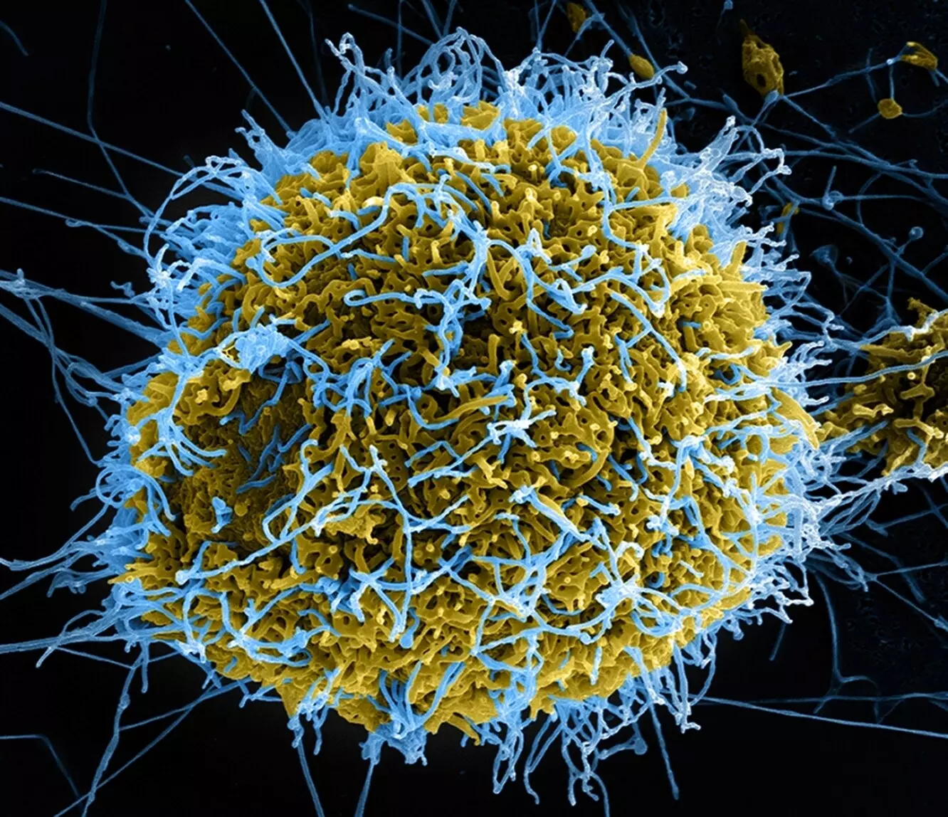 Էբոլա վիրուսը (կապույտ) հարձակվում է բջիջի վրա (դեղին):