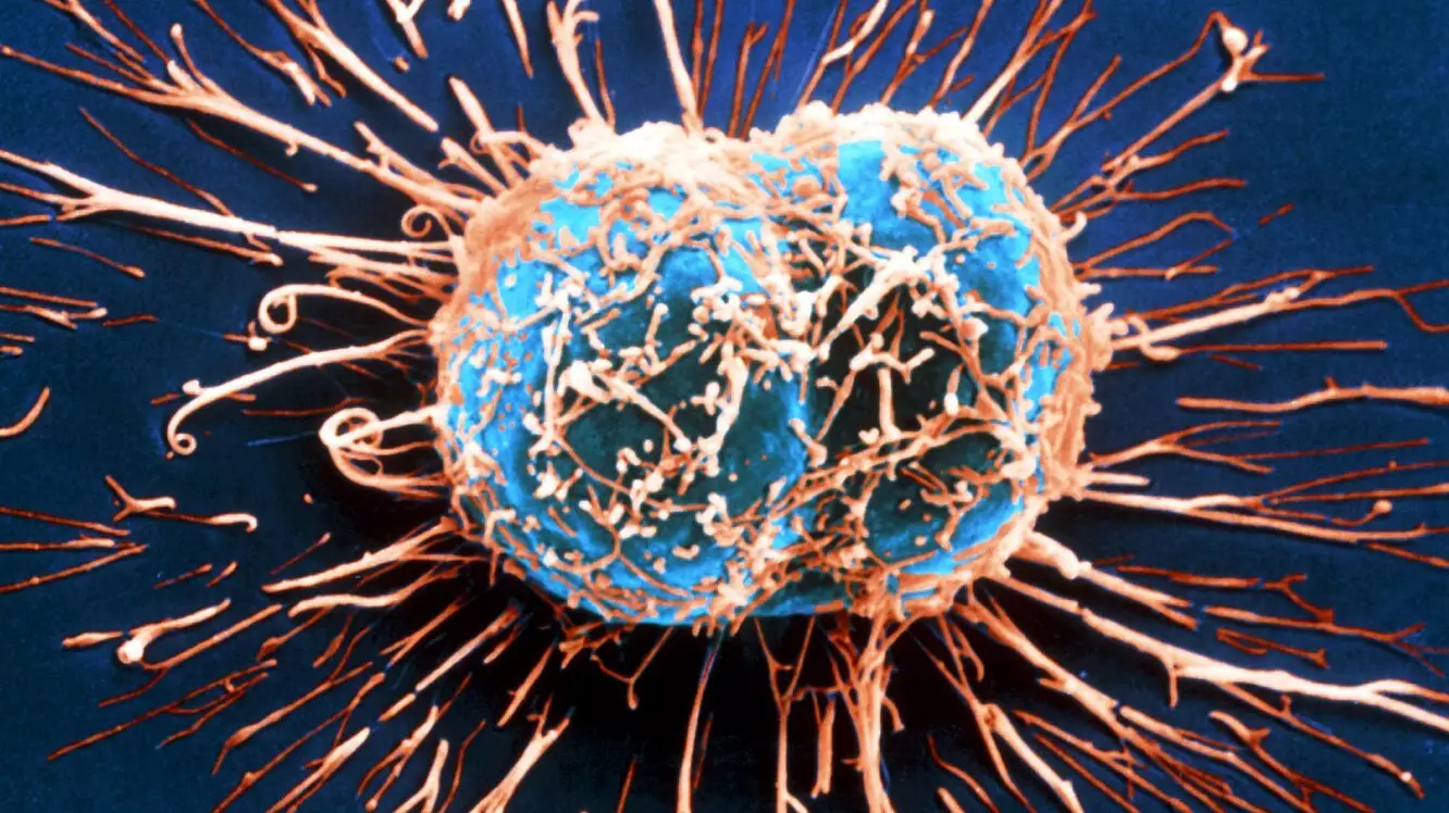 Alice dalam sel kanker: tumor dalam realitas virtual 344575_2