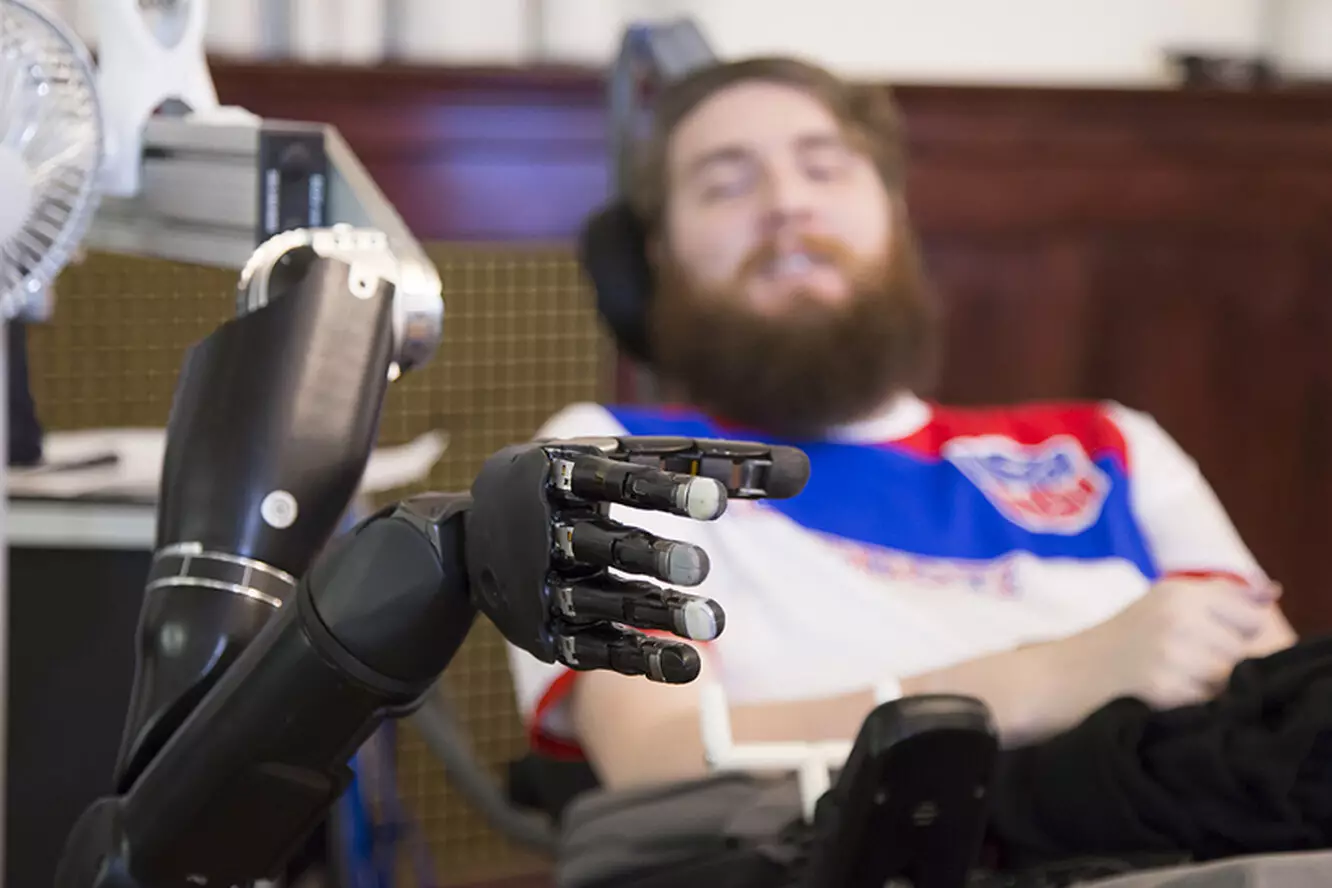 Brain implant and prosthesis restore sense of touch to paralyzed man