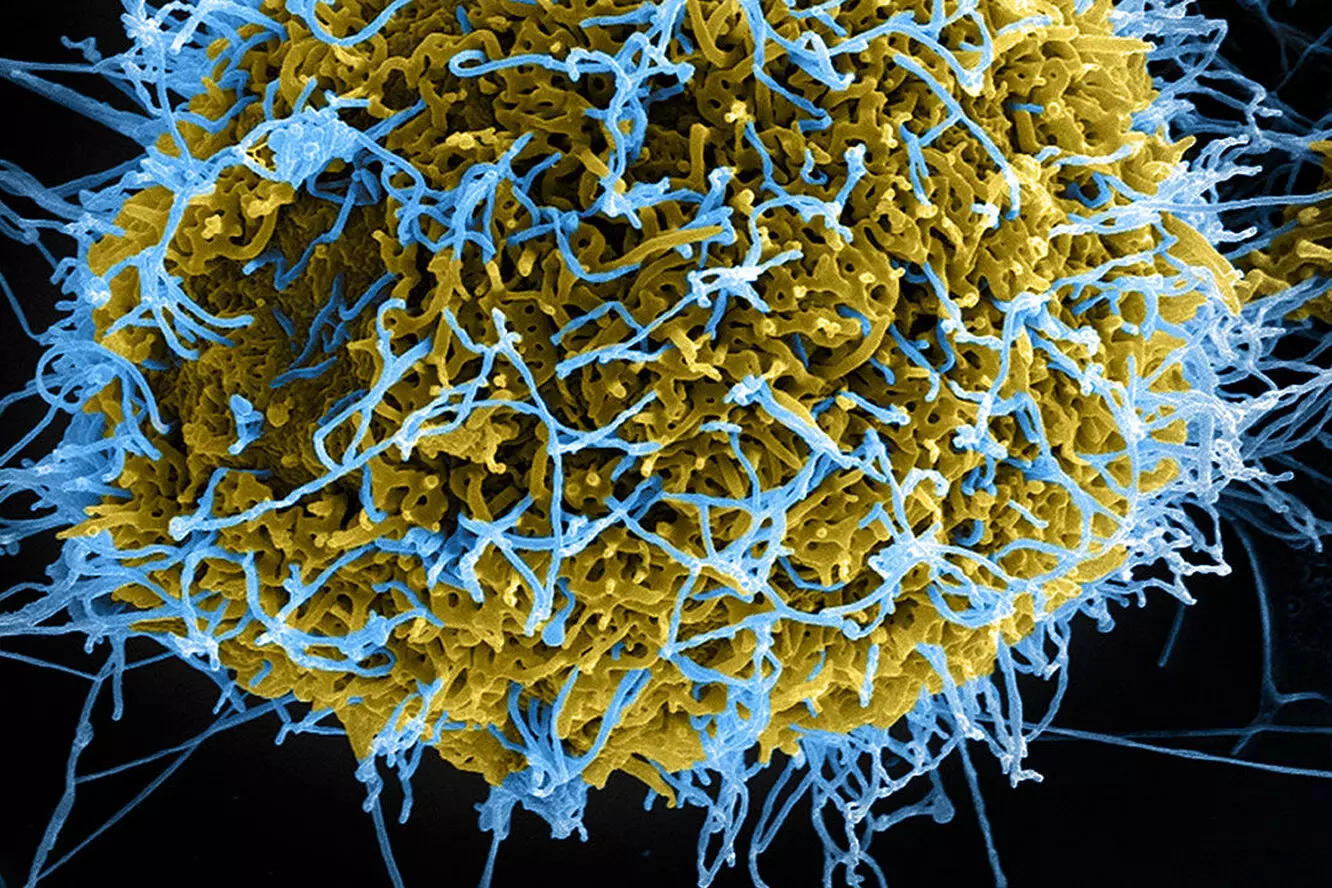 इबोला भाइरसमा उत्परिवर्तनले महामारी निम्त्यायो: नयाँ अनुसन्धान