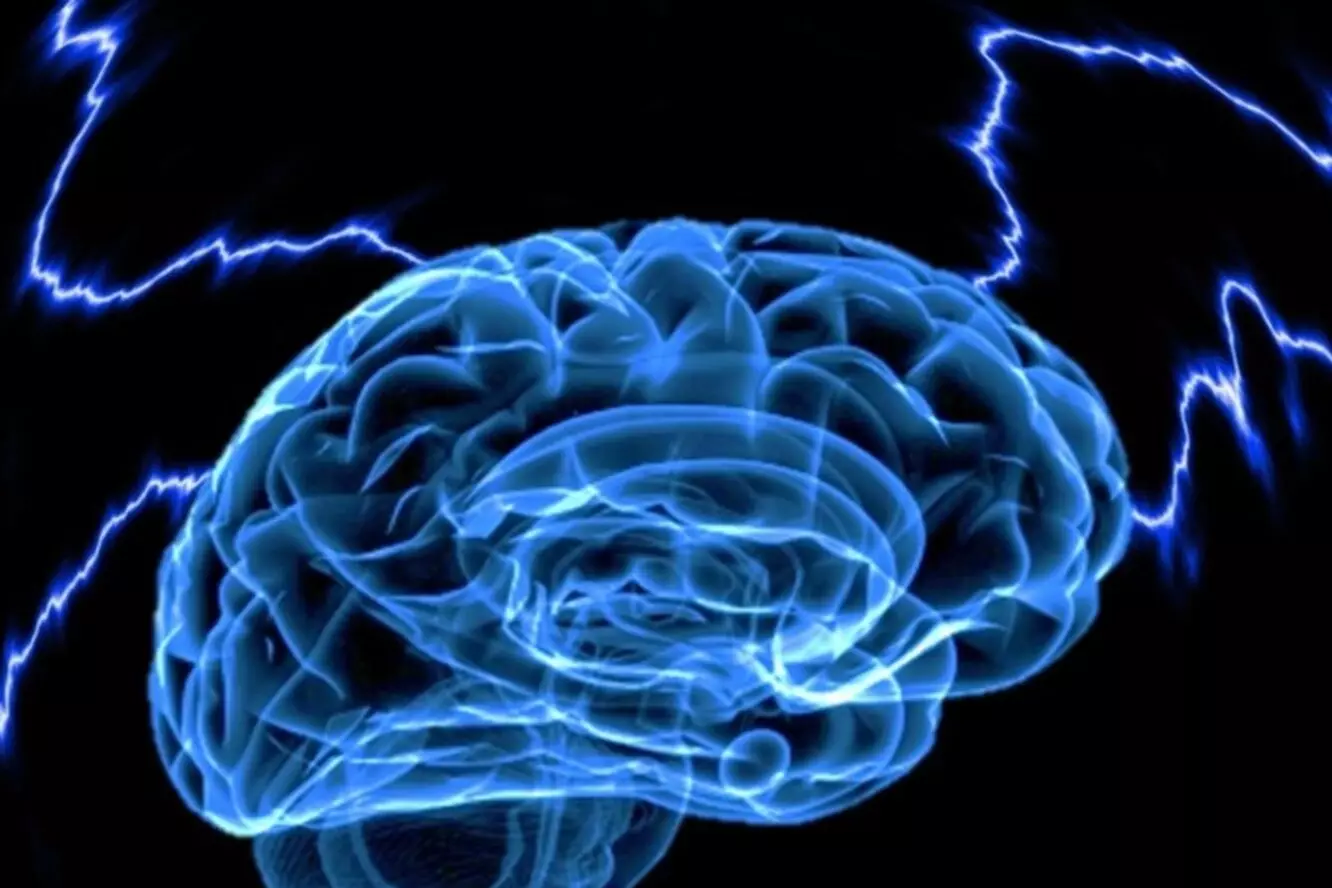 Para ilmuwan dapat memprediksi tingkat disonansi kognitif dari aktivitas otak