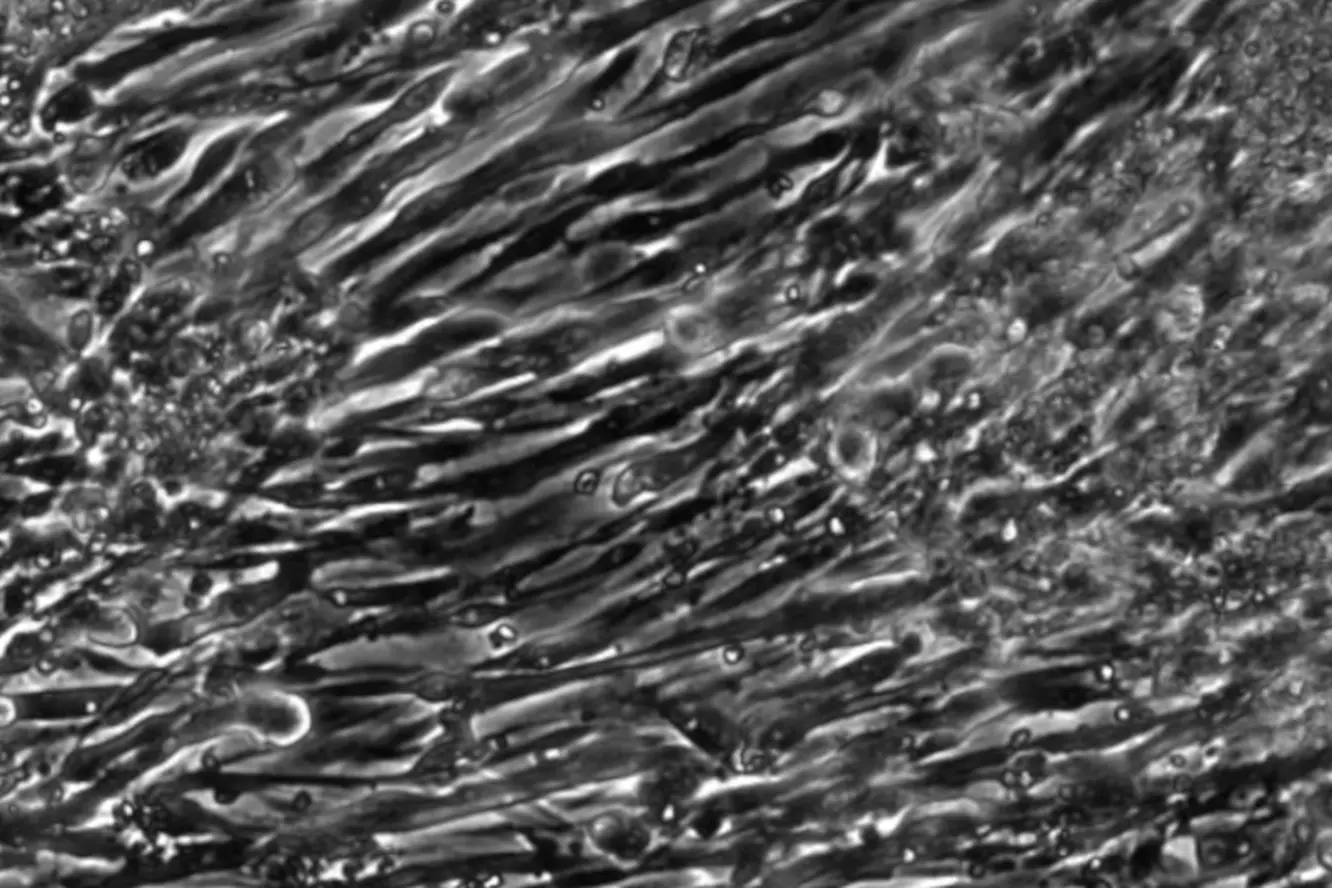 Muscle tissue grown from stem cells