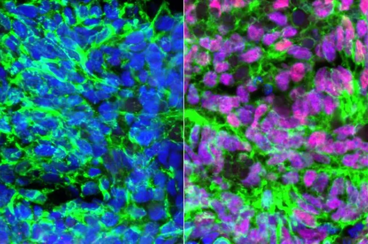 Comment les cellules souches renvoient des sensations tactiles aux personnes paralysées 354674_2