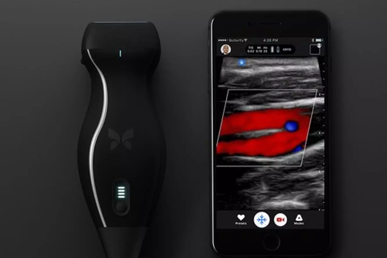 Ultrazvuk v každé domácnosti: kompaktní zařízení, které spolupracuje se smartphonem