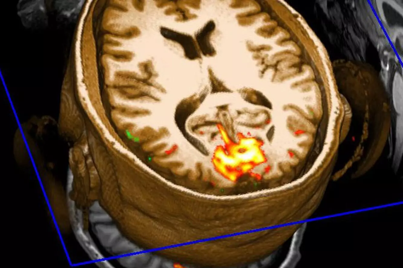 Ihe mere anyị ji dị umengwụ - ihe kpatara physiological