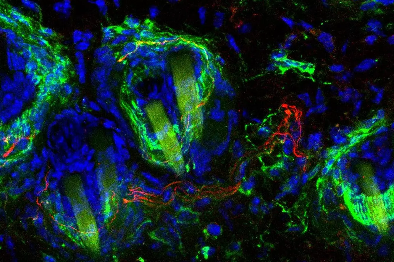 Wie wird Licht zur Schmerzmedizin?