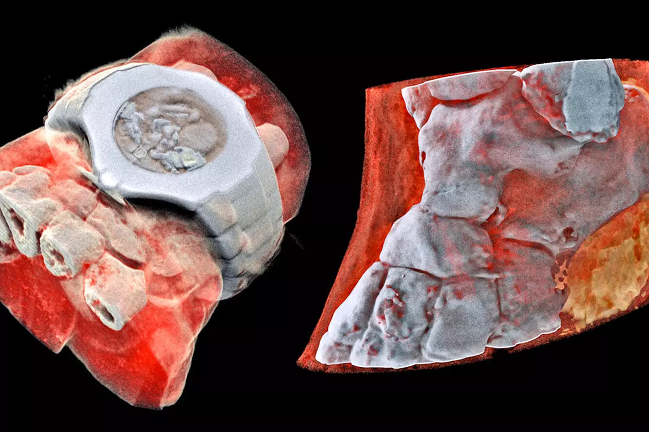 The world's first color 3D X-ray: how to look inside the body without opening