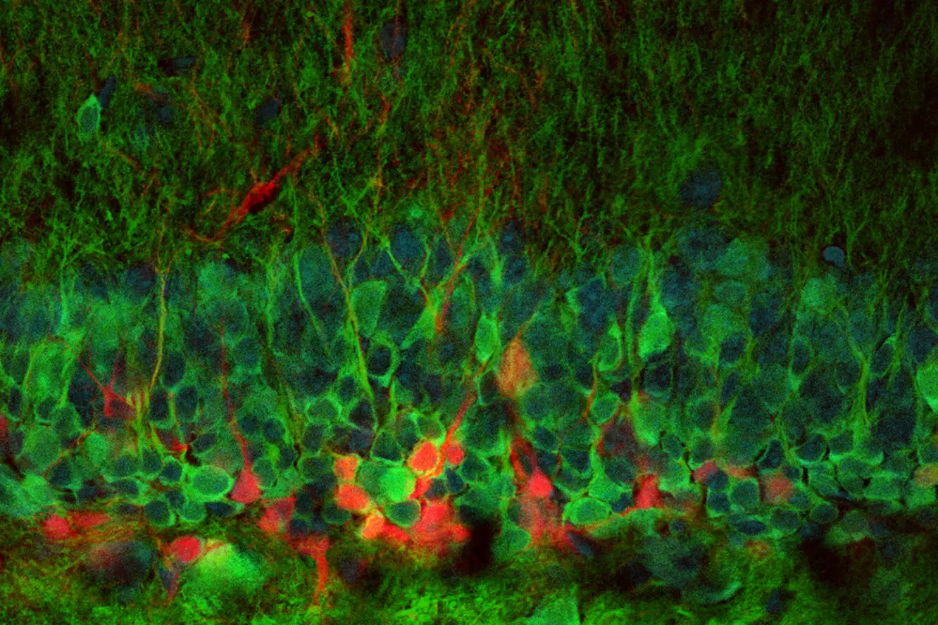 A na-eweghachi mkpụrụ ndụ akwara: ka neuron si eto na anụ ahụ ụbụrụ