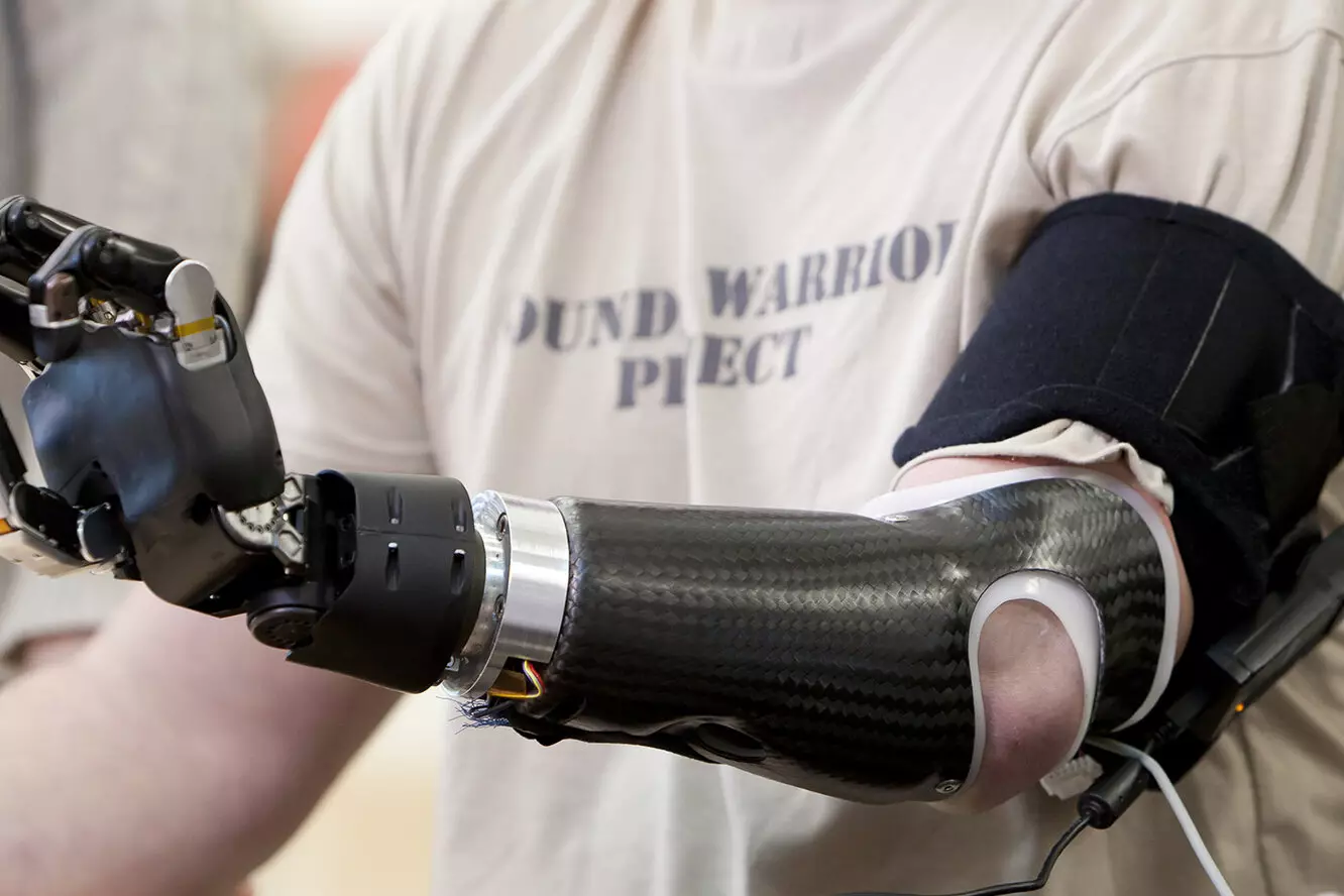 What are limb prostheses and how do they work?