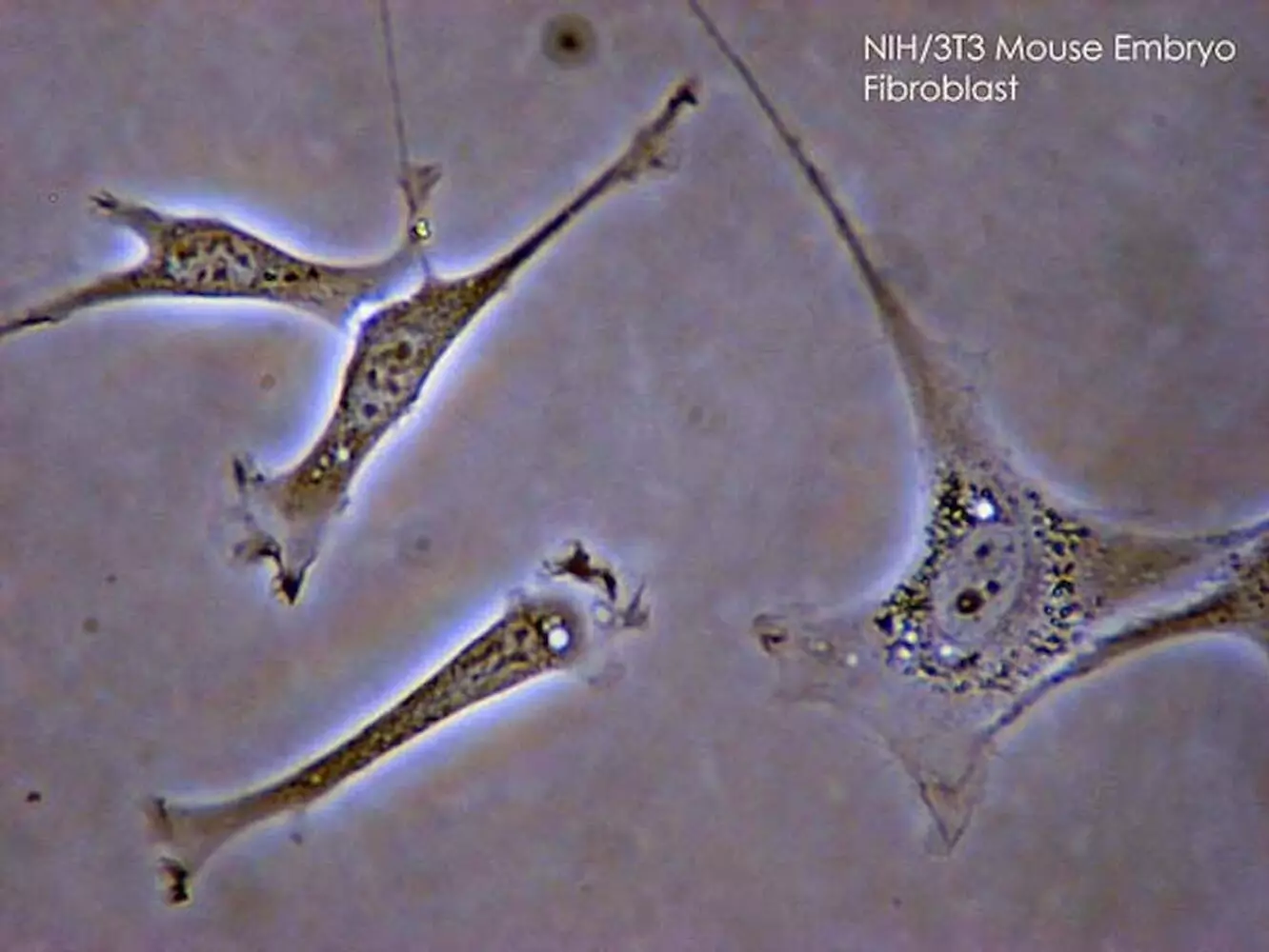 Myšie embryonálne fibroblasty pod mikroskopom