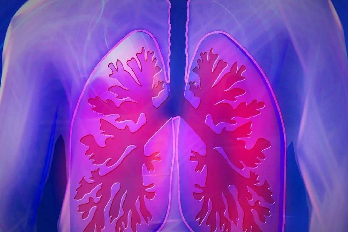 O patólogo describiu os pulmóns dos pacientes con infección por coronavirus 371014_1