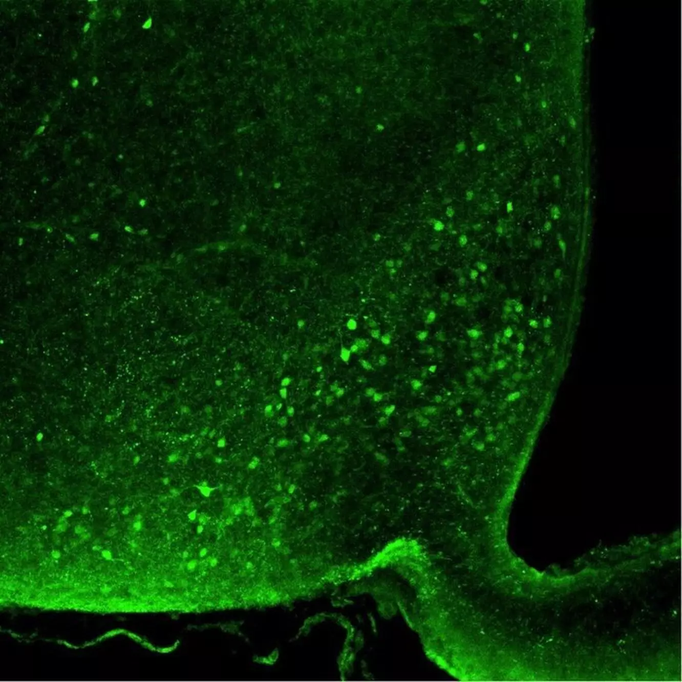 Neurons ayaa la ogaaday inay sababaan cunto badan 371028_2