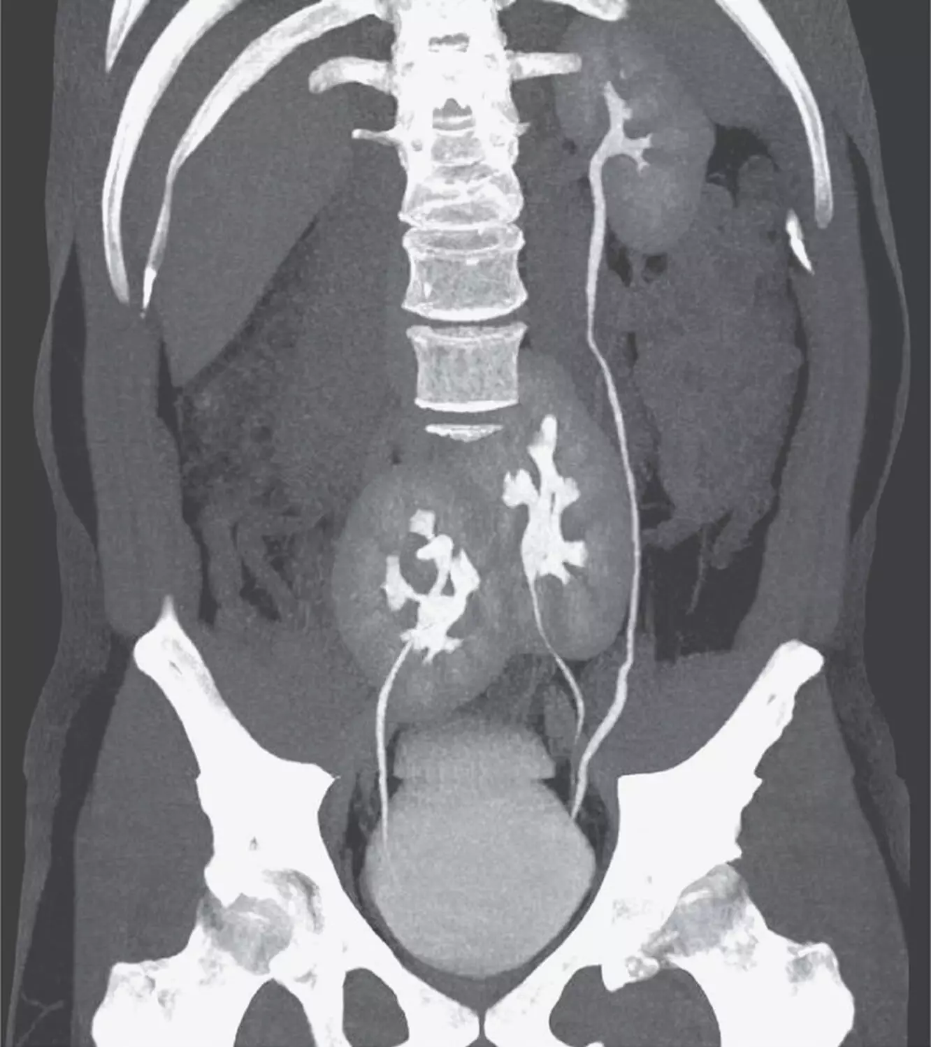 Biglang nalaman ng middle-aged na lalaki na may extra siyang kidney 371822_2