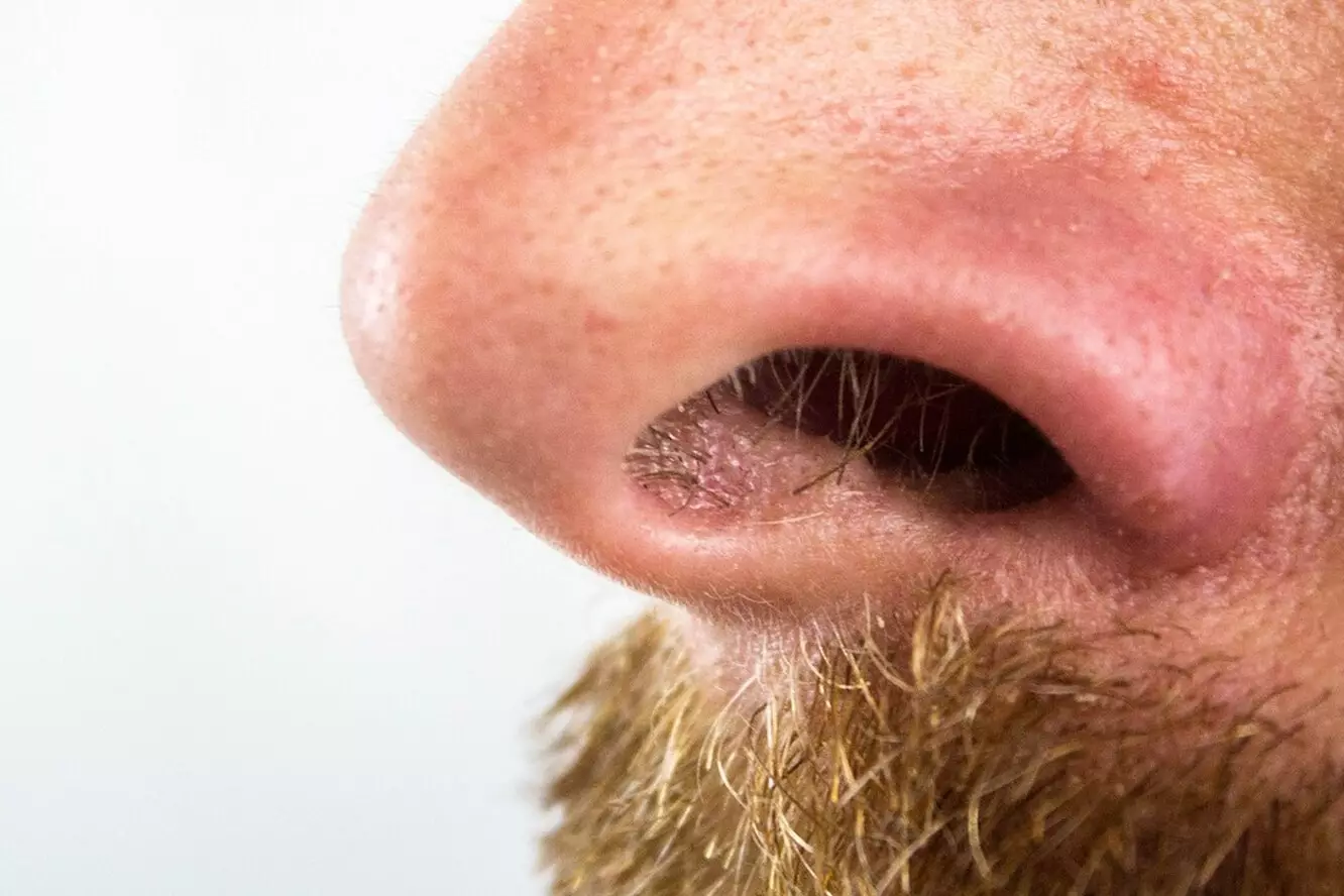 Lactobacilli bermanfaat yang terdapat dalam hidung