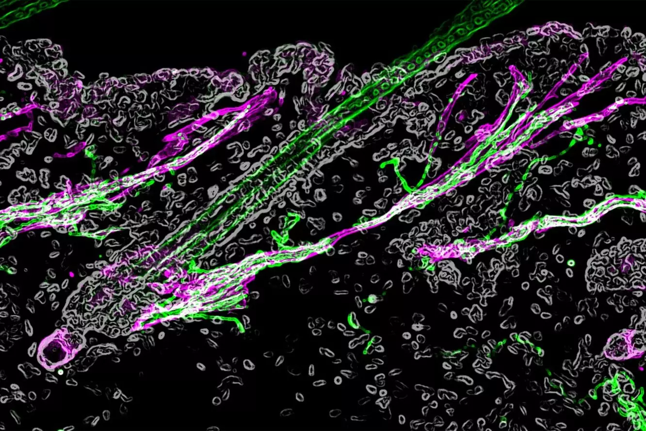 Folículo piloso sob o microscópio