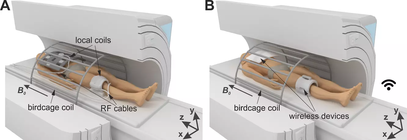 A - Utaratibu wa kawaida wa kliniki wa MRI; B - Mbinu mpya