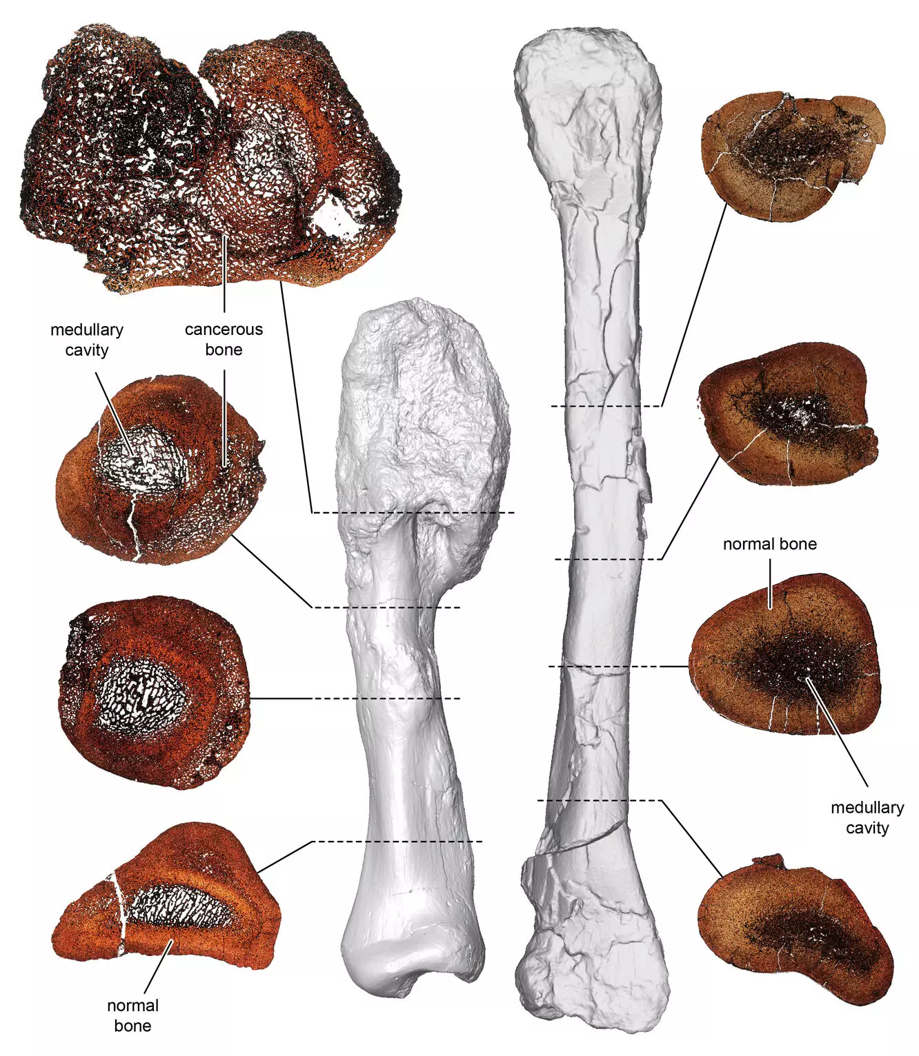 Comparison of thin sections of a tumor-bearing tibia (left) and a normal centrosaurus tibia