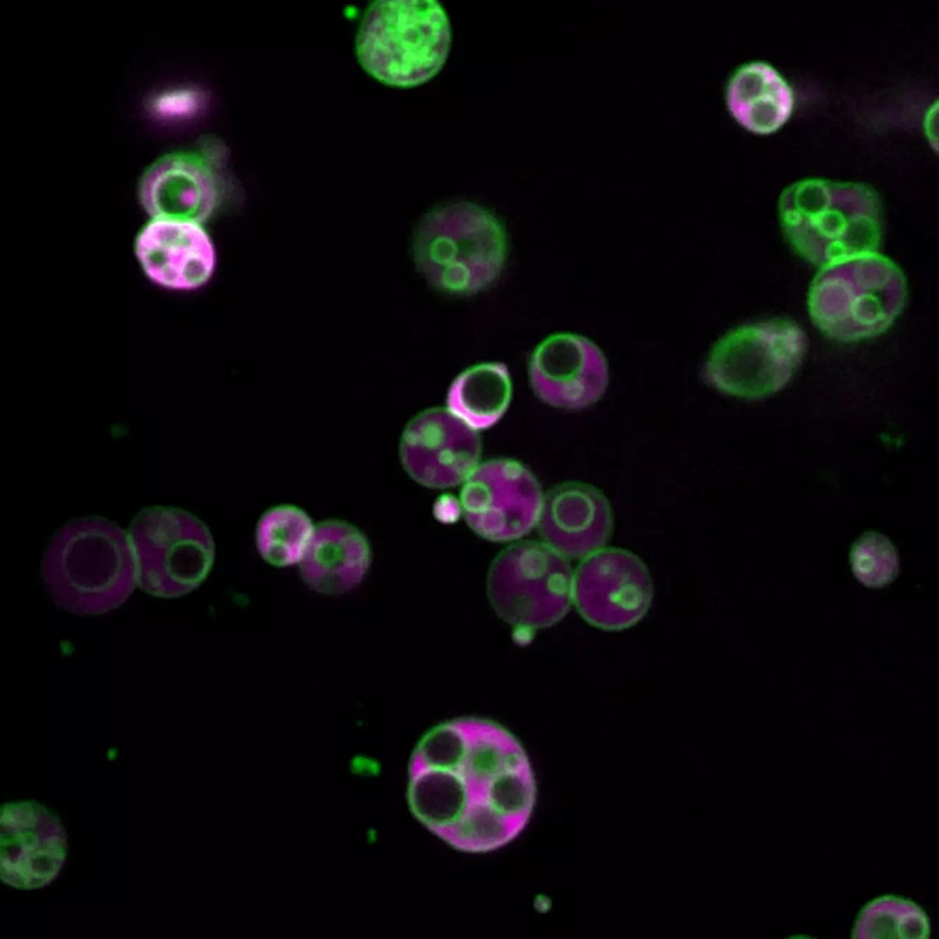 Peroxisomen argazkilaritza