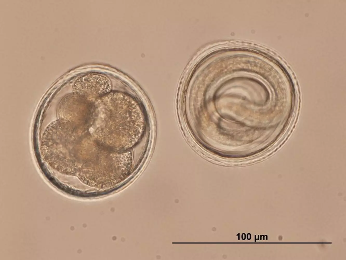 Birus, bakterio eta parasito hilgarriak kaleko zikinkerian 382458_3