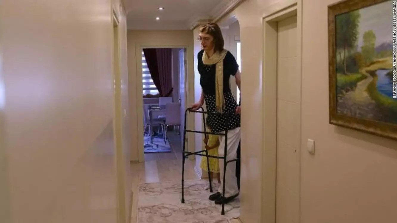 The tallest woman in the world became a resident of Turkey 389896_2