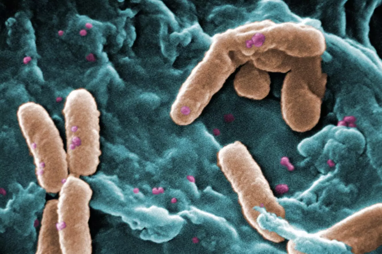 Russische Wissenschaftler haben eine neue Methode zur Bekämpfung von Superbugs vorgeschlagen. Die wichtigsten wissenschaftlichen Nachrichten von heute